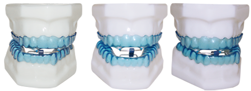 Dispositivo de avance mandibular (DAM) - Clínica Somno